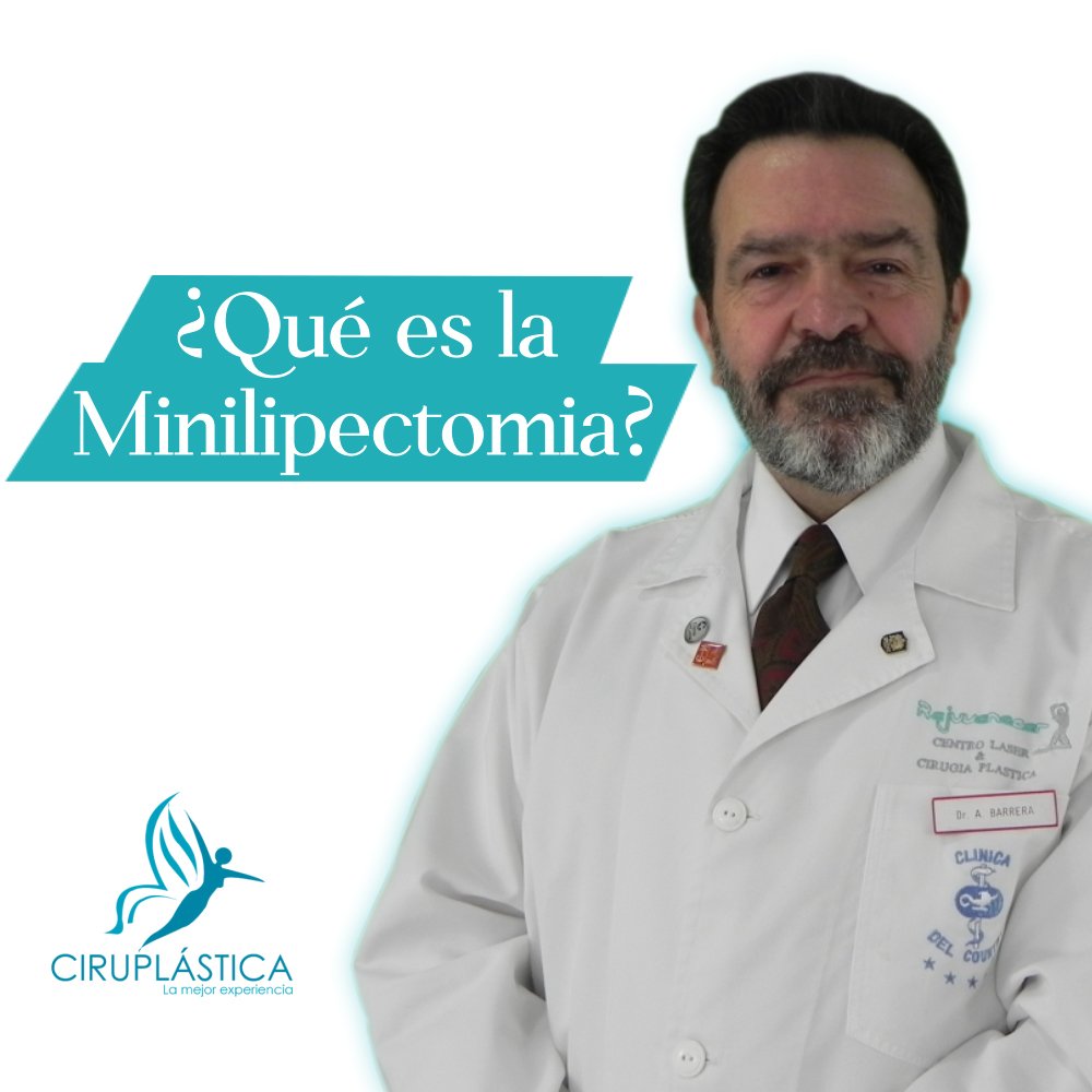 Todo Lo Que Necesitas Saber De Una ABDOMINOPLASTIA - LIPECTOMIA